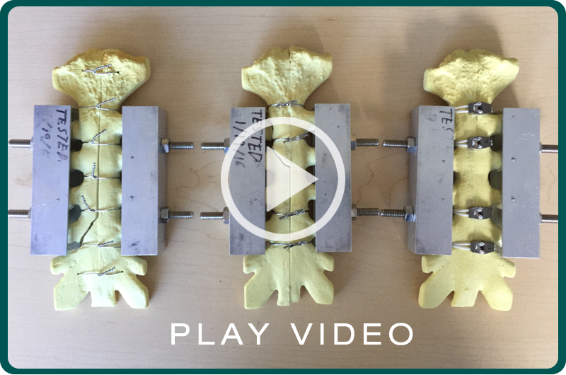 Supercable® Polymer Iso Elastic™ Sternotomy Closure System Kinamed