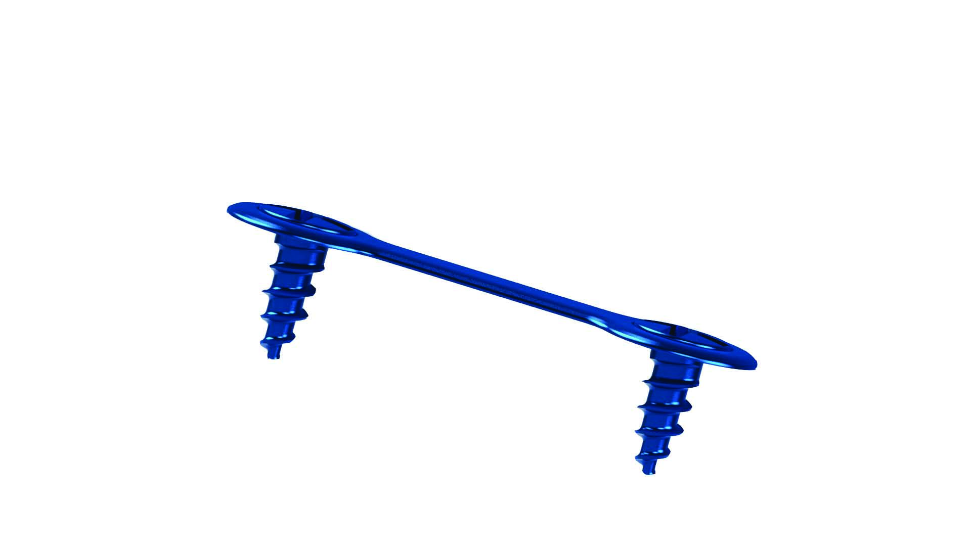 NeuroPro® Low Profile Rigid Fixation System | Kinamed Incorporated